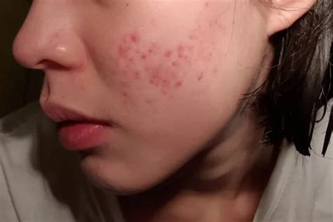 Meminimalisir Kesalahan Saat Pemilihan Produk Skincare Wajib Tahu