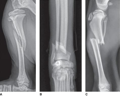 9 Fracturesand Fracturehealing Veterian Key