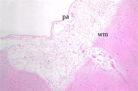 Histopathology Of The Telencephalic Cortex Of Sheep 5 Recovered From