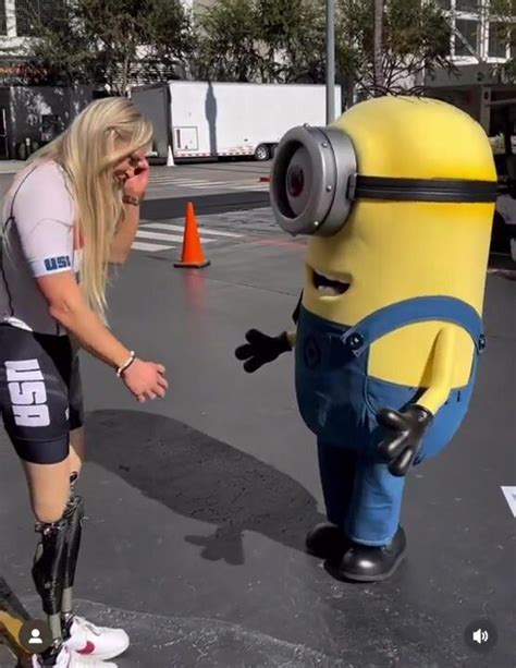 Dak Amputee On Prosthetics