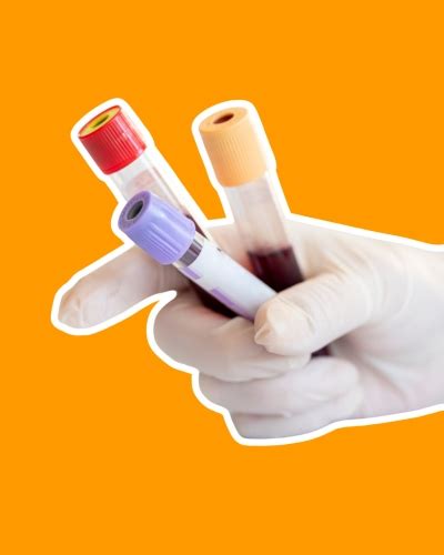 Top 10 Reasons To Get The Afp Tumor Marker Test Wittmer Rejuvenation