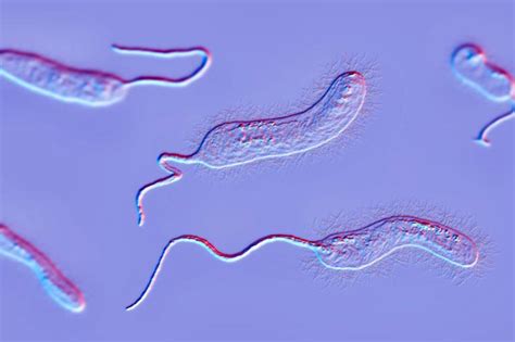 Raw Oysters Linked To Major Salmonella Outbreak In Three Us States