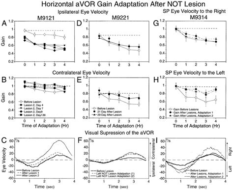 Horizontal Angular Vestibulo Ocular Reflex Avor Gain Adaptation After
