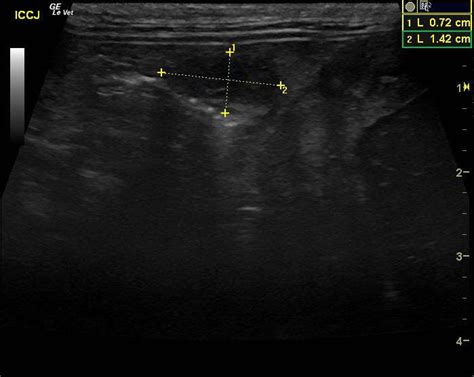 05 00086 Murphy W Pancreatic Abscesspotential Com Nvc Members