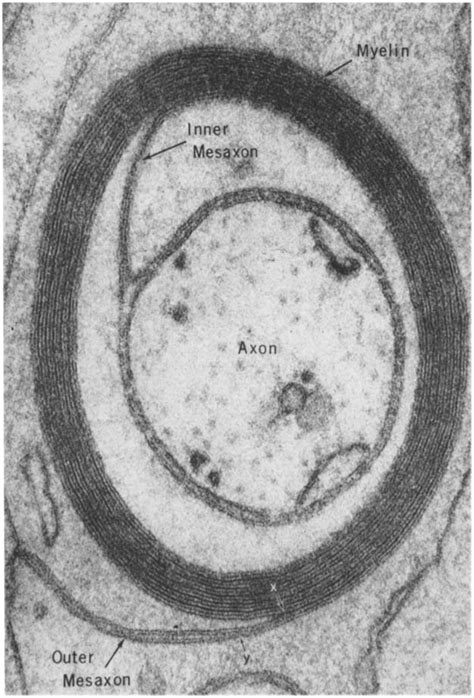 An Electron Micrograph Of A Myelinating Fiber From Mouse Sciatic Nerve