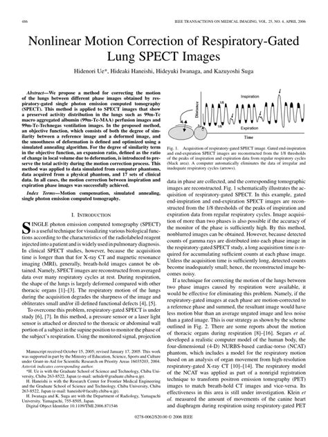 Pdf Nonlinear Motion Correction Of Respiratory Gated Lung Spect Images