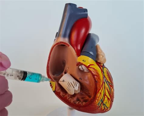 Intracardiac Injection Intra Cardiac Injection Of Human Prostate