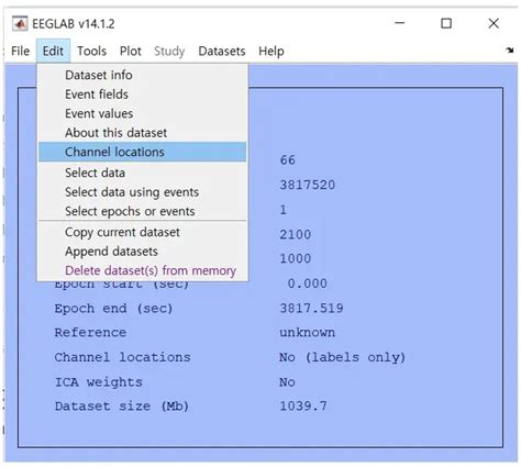 Matlab脑电数据处理精要（三、实操） 知乎