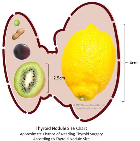 Things To Know About Thyroid Nodule Size Plus Size Chart