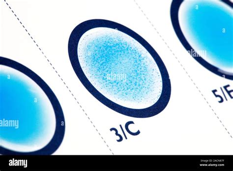 Streptococcus Grouping Test This Is The Streptocard Acid Latex Test Used To Identify Serotypes