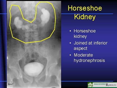 Fetal Abnormalities And Anomalies Fetal Abnormalities Detectable By