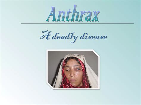 Anthrax Disease Ppt