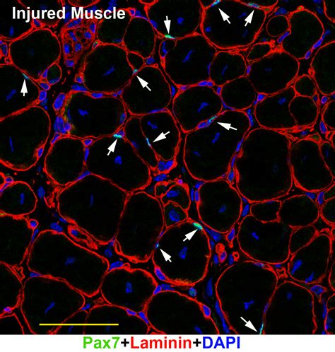 Identification Of Skeletal Muscle Satellite Cells By Immunofluorescence