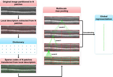 Fully Automated Macular Pathology Detection In Retina Optical Coherence
