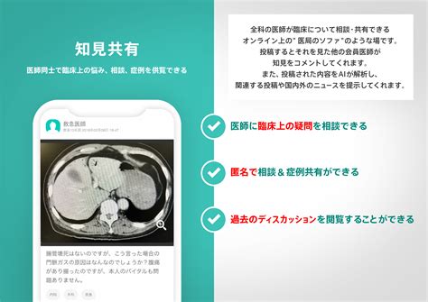 Hcnチャネル：機能と臨床的意味 Bibgraph（ビブグラフ） Pubmedを日本語で論文検索