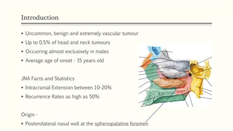 Juvenile Nasopharyngeal Angiofibroma Pptx