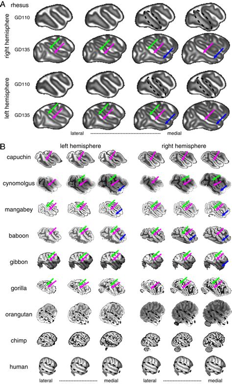 Anatomical Correlates Of Face Patches In Macaque Inferotemporal Cortex Pmc