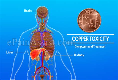 Copper Toxicity Symptoms