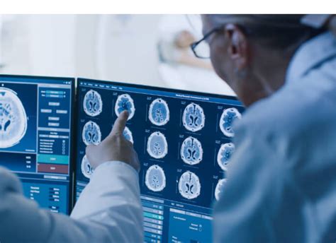 MRA Vs MRI Brain Aneurysm Foundation