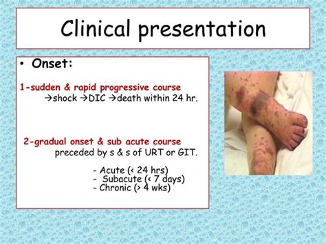 Cns Infection 2019 Ppt