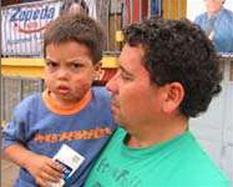 Intenta Quemar Una Muñeca Endemoniada Y Produce Una Explosión Infobae