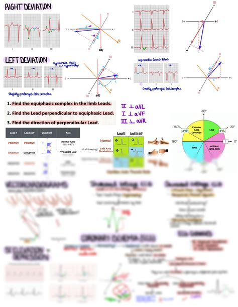 Solution Physiology Vectorial Analysis Ecg Studypool