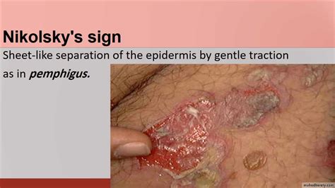 Diagnosis Of Skin Diseases Pptx D Hadf Muhadharaty