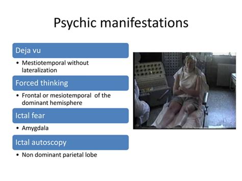 Semiology Of Seizures Pptx