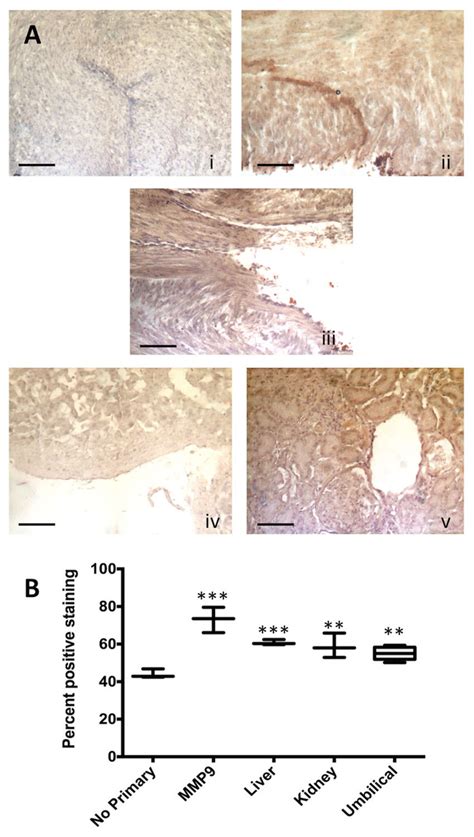 Immunohistochemical Expression And Localization Of Bcrp In Human