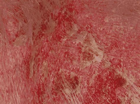 Canine Recurrent Superficial Pyoderma Veterinary Practice Canine Recurrent Superficial Pyoderma Veterinary Practice