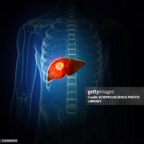 Liver Position Photos And Premium High Res Pictures Getty Images