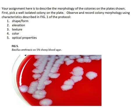 Solved Your Assignment Here Is To Describe The Morphology Of