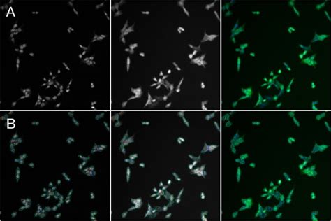 Single Particle Analysis Workflow Thermo Fisher Scientific UK