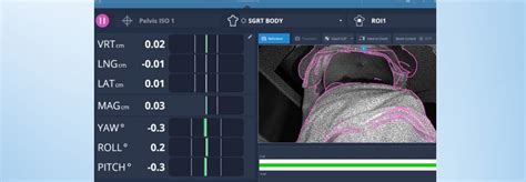 Alignrt And Prostate Treatments Non Invasive Therapy Solutions