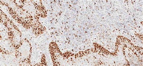 Antibody Optimization Glint Lab Website