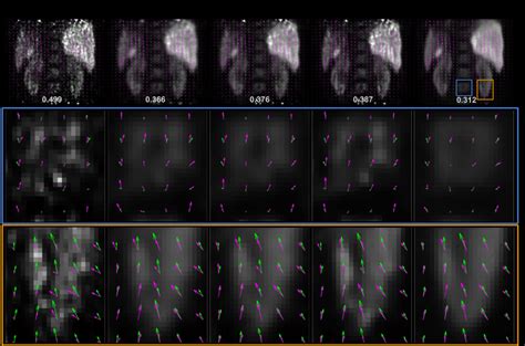 Qualitative Illustration Of Motion Estimation Results From Different