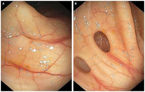 What Is This Lesion Called 🦠dx Diagnosis Of Disease