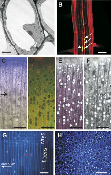 Specific Characteristics Of Xylem Cell Death A Electron Transmission