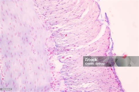Backgrounds Of Characteristics Tissue Of Jejunum Human Under Microscope