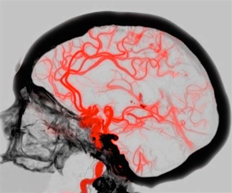 Science News Human Mini Brain On The Move Grown In Lab In Brain