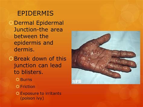 Structures Of The Skin Hct I Ppt Video Online Download