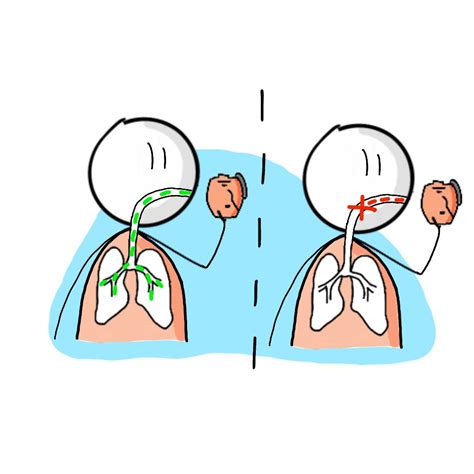 Copd Inhalertherapy Realworldevidence Nrs Science