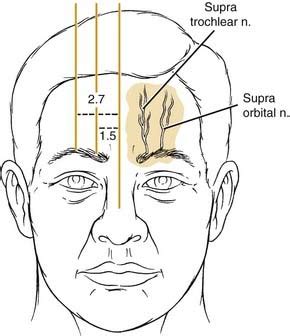 Supraorbital Nerve Anatomy