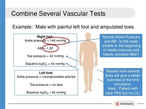 Interpreting Toe And Ankle Pressure Curves And Results When Using Per