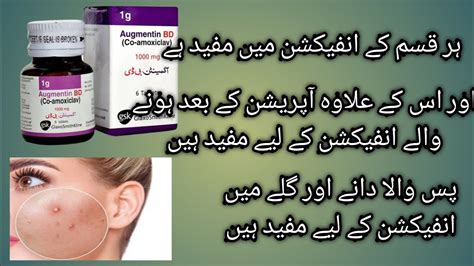 Augmentin 625mg Tablets Uses In Urdu Tablet Augmentin Benefits And Side Effects Youtube