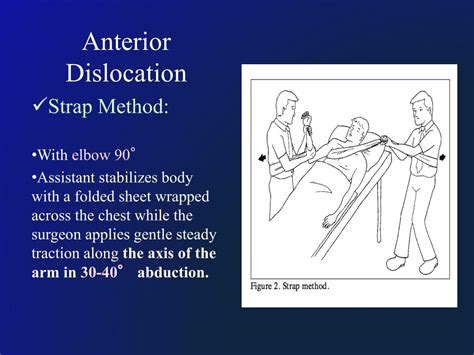 Ppt Shoulder Dislocation Powerpoint Presentation Free Download Id4841498
