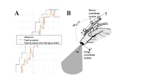 temporal a and spatial b calibration of the ultrasound probe