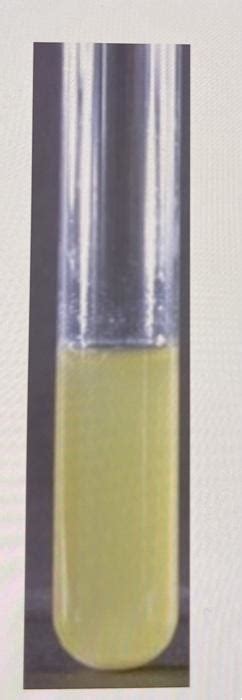 Solved Thioglycollate Testhow Would You Describe The Oxygen