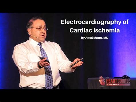 Free Video Electrocardiography Of Cardiac Ischemia The Heart Course Ecg Workshop From The