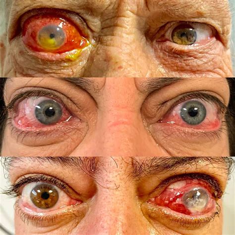 Optometry Case Optometry Case Added A New Photo